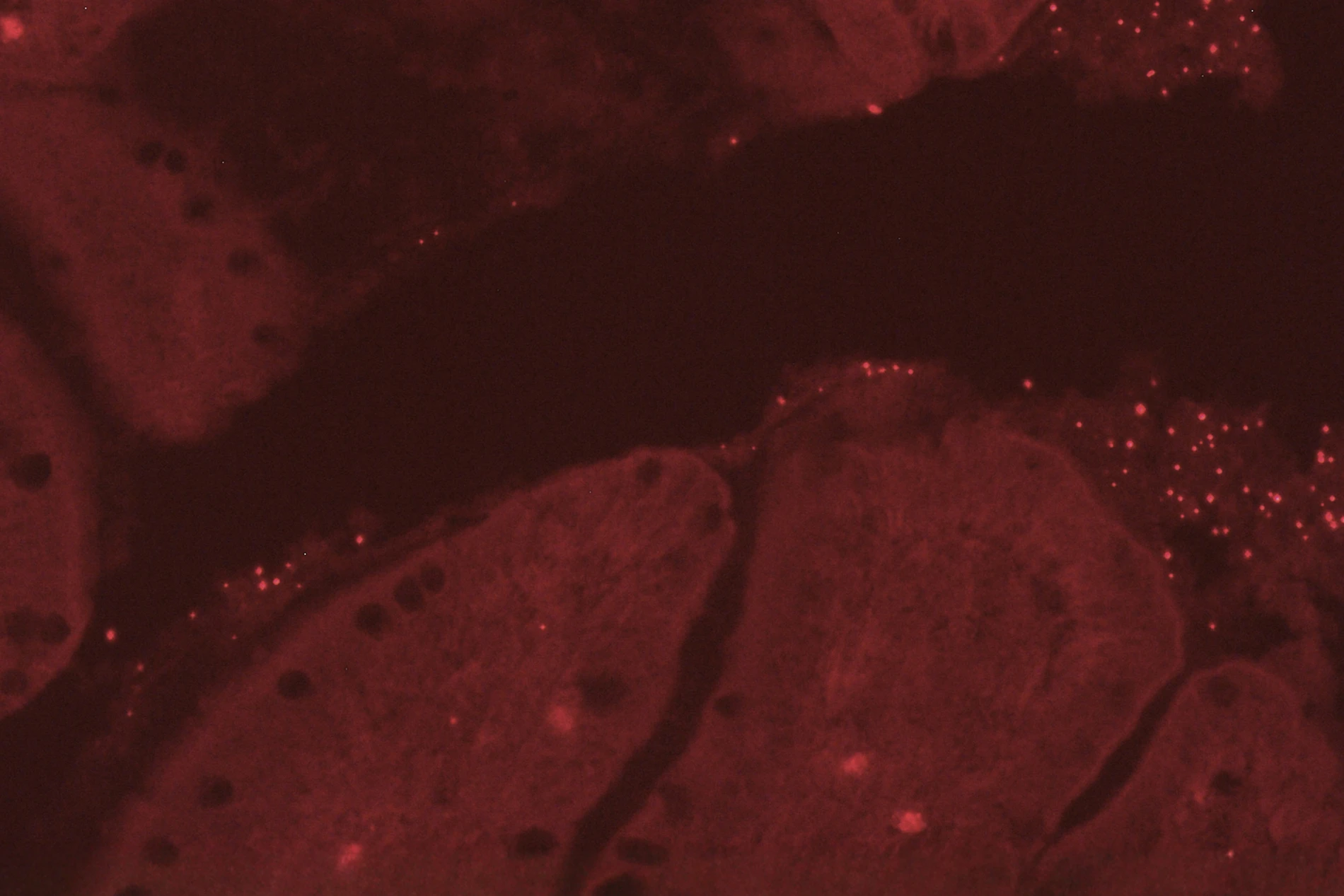 The power of a robust microbiome | Novonesis